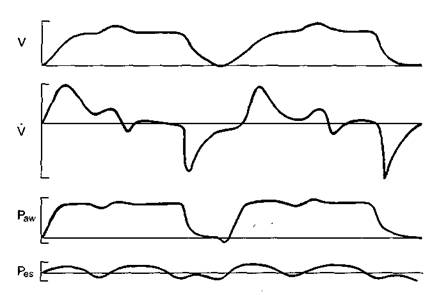 Режимы Biphasic Positive Airway Pressure (BIPAP) и Airway Pressure ...